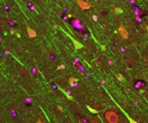 Science Behind the Discoveries - AKAVA THERAPEUTICS